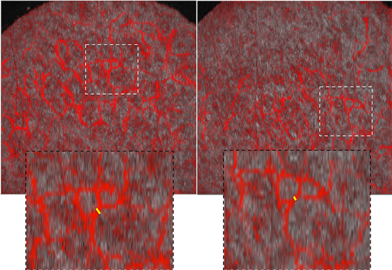 Skin Vasculature & Blood Flow – VivoSight