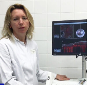 BCC & SCC – VivoSight